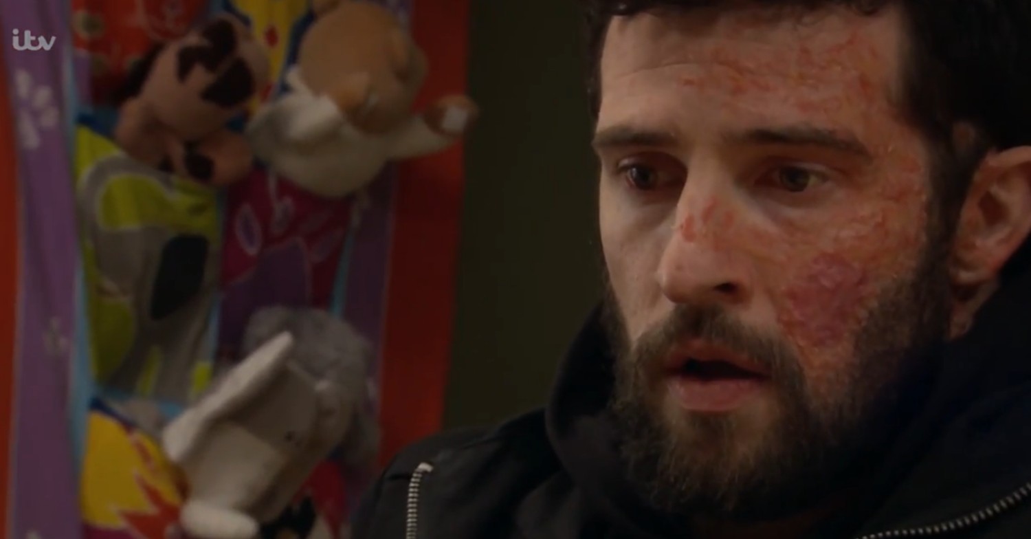 Ross Barton and his time in Emmerdale: Affair with Debbie, acid attack ...